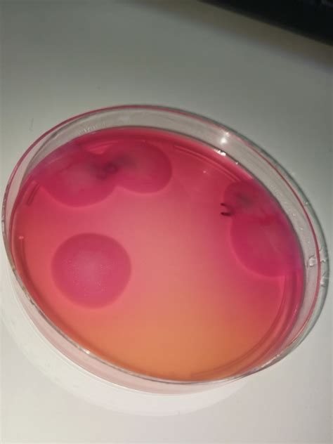 What Is Bacillus Cereus Bacillus Cereus B Cereus Is A Spore Forming Bacteria That Is So