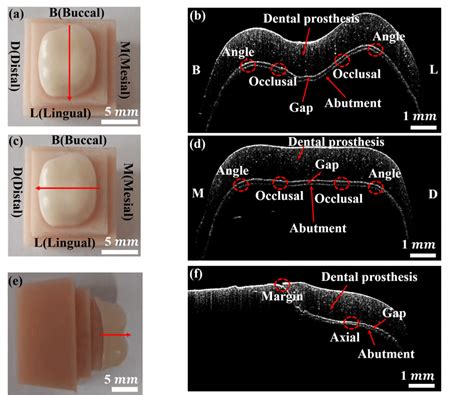 Scan Position Of A Sample And OCT Images A B L Scan Position B Download Scientific