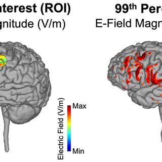 E Field Modeling Pipeline E Field Modeling Entails Five Main Steps Download Scientific
