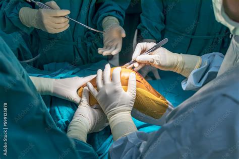 Doctor Or Orthopedic Surgeon In Green Uniform Holding Medical Scalpel