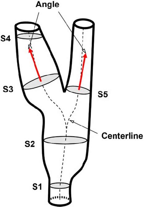Bifurcation Geometry Of Pa03 Showing The Centerline Of The Artery And Download Scientific
