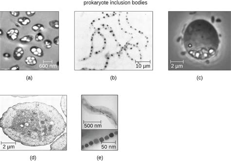 Prokaryotic Vs Eukaryotic Cell Under Microscope