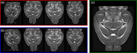 Whole Mouse Brain Imaging Using Optical Coherence Tomography Reconstruction Normalization