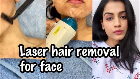 Permanent Upper Lip Hair Removal Cost In India