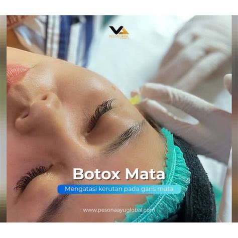 Jual BOTOX Shopee Indonesia