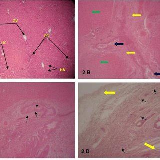 Sex Differences In Prevalence Of Liver And Lung Lesion Download Scientific Diagram