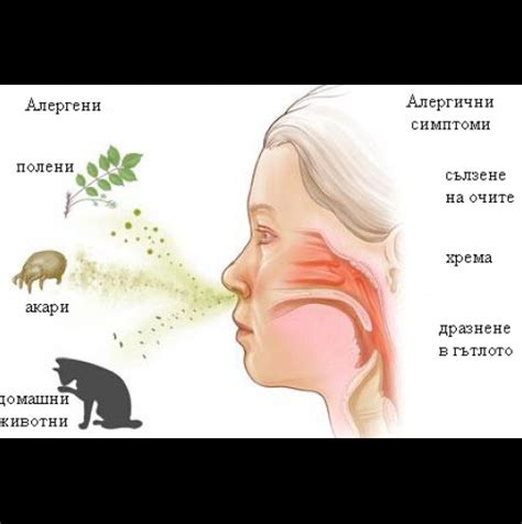 Ето как да разберете че със сигурност страдате от алергия За Жената