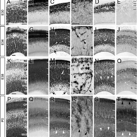 Distribution Of Neuronal Cells And Processes In The Prospective Ferret Download Scientific