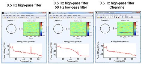 A Filtering Eeglab Wiki