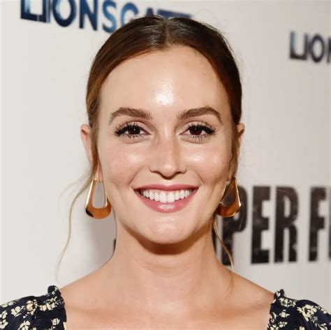 🦷causes Et Traitements Du Diastème