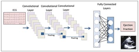 Artificial Intelligence Enabled Ecg Screening For Asymptomatic Left Ventricular Dysfunction