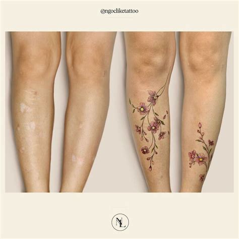 50 Times People Asked To Cover Up Their Scars And This Tattoo Artist