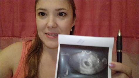 Я беременна первое УЗИ и самочувствие до 4 недель Youtube