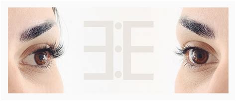 Dr Dk The Best Rhinoplasty Surgeon London Rhinoplasty Perfection For