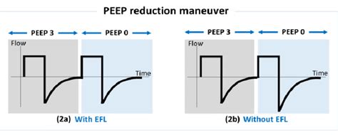 This Figure Demonstrated The Flow Time Waveform Of 2 Consecutive