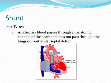 PPT RESPIRATORY FAILURE And ARDS PowerPoint Presentation Free Download ID