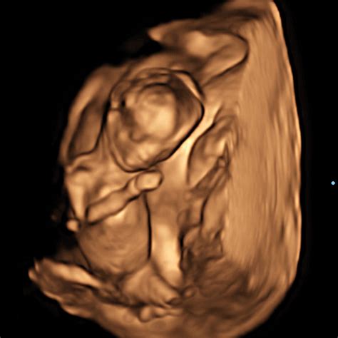 15 Week Ultrasound 3d