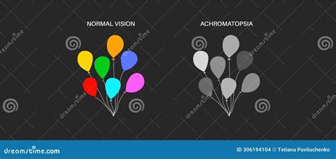 Achromatopsia Vision Deficiency Stock Vector Illustration Of Spectrum Colorimetry 306194104