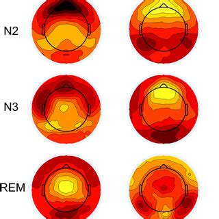 Relative Topographic Distribution Of EEG Waves With Durations Of Download Scientific Diagram