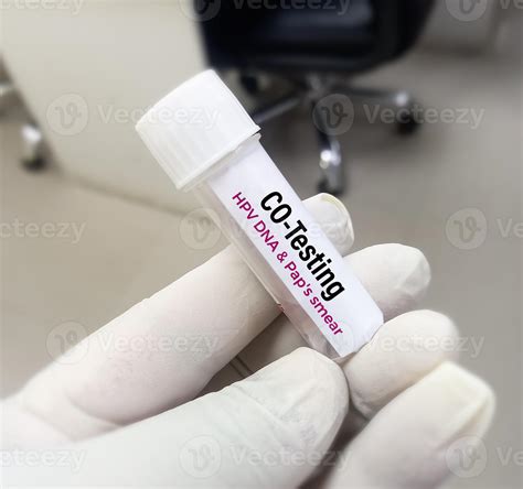 Vaginal Fluid Sample For Co Testing Or Hpv Dna Test And Lbc Test Human Papilloma Virus