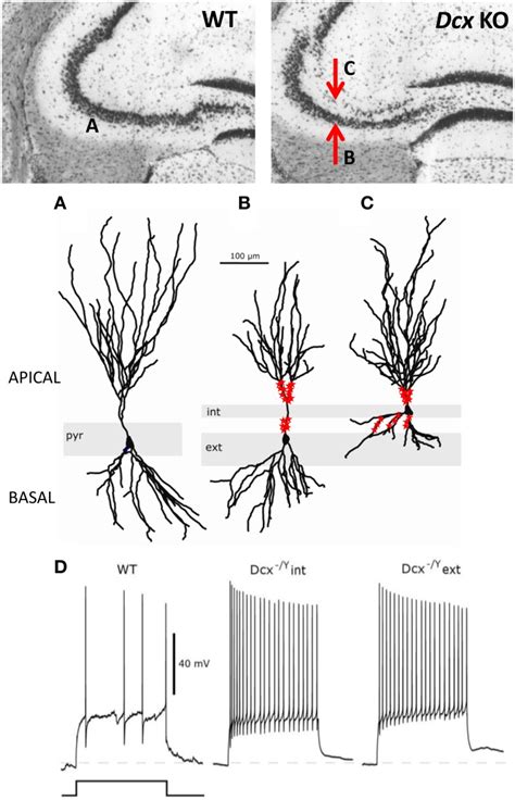 Morphological And Functional Abnormalities In The Dcx Ko Hippocampus