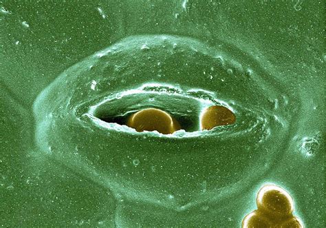 29 Facts About Stoma