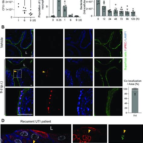 Upec Persist In Bladder Epithelial Cells A Prolonged Bacterial Burden Download Scientific