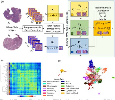 Histokernel Whole Slide Image Level Maximum Mean Discrepancy Kernels