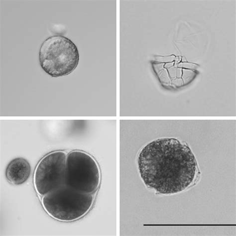 Examples Of Light Micrographs Used To Identify Cysts And Vegetative Download Scientific Diagram
