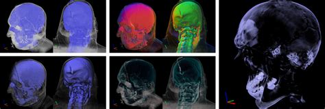 Different Renderings Of A CT Data Set Top Left Use Of A Basic 1D Download Scientific Diagram