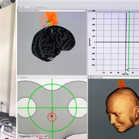 Neuronavigation System Download Scientific Diagram