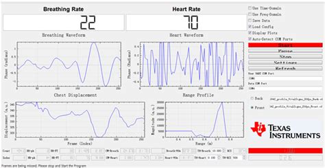 Ccsawr1642boost Awr1642boostdo Not Send Vital Signs After Upper