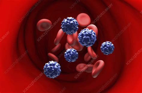 Parvovirus B19 Infection Illustration Stock Image F0425768