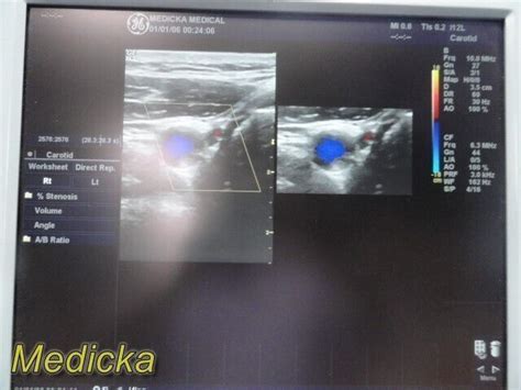 Used GE HEALTHCARE GE I12L Linear Array Ultrasound Transducer For Sale DOTmed Listing 4749820