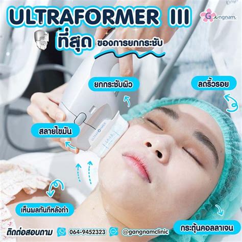 Ultraformer Iii คืออะไร ช่วยเรื่องอะไรบ้าง ทำแล้วเห็นผลจริงไหม