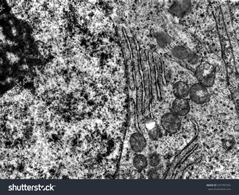 Transmission Electron Microscope Micrograph