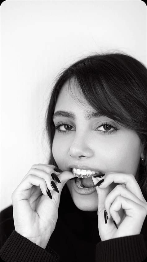 ‎dr Kianipour دکتر کیانی پور‎ ‎الاینر بدون نیاز به سیم و براکت، دندان