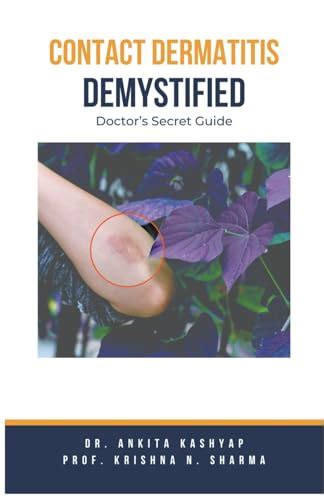 Contact Dermatitis Demystified Doctors Secret Guide By Dr Ankita
