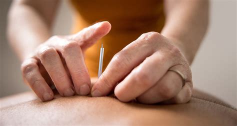 Union Wellness Central Seattle Trigger Point Dry Needling