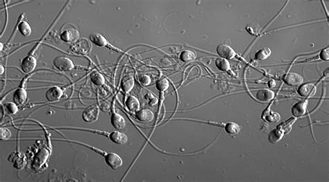 Semen Under Microscope