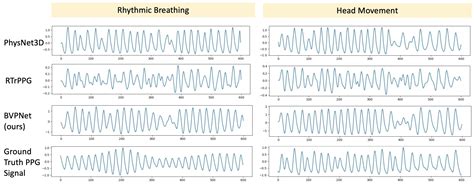 Ibvp Dataset Rgb Thermal Rppg Dataset With High Resolution Signal