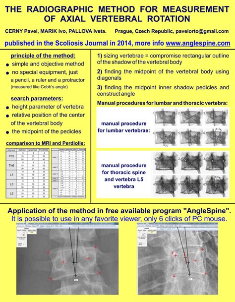 Pdf The Radiographic Method For Measurement Of Axial Vertebral Rotation