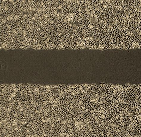 细胞划痕实验详细步骤，手把手教你做！