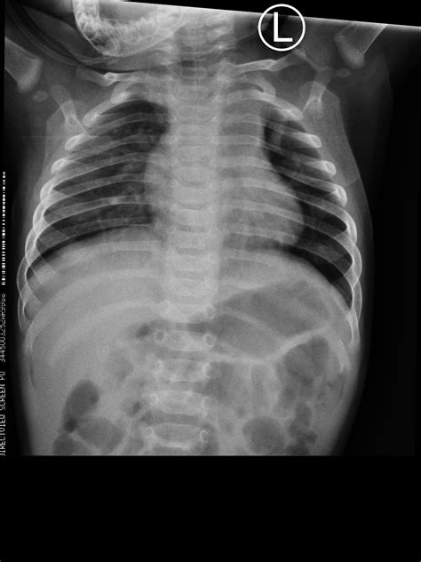 Object Detection Test Object Detection Dataset By Project