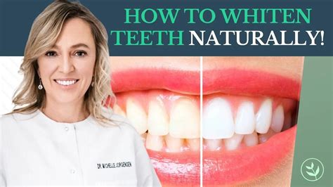 How To Whiten Teeth Naturally Proven Tips For A Brigher Smile