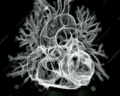 Healthy Heart Ct Scan Stock Image C0573571 Science Photo Library