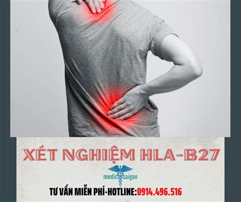 XÉt NghiỆm Hla Xét Nghiệm Đà Nẵng Dịch Vụ Xét Nghiệm Máu Uy Tín Tại Đà Nẵng