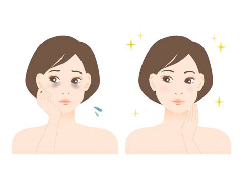 Can You Permanently Remove Dark Circles McCracken Blog