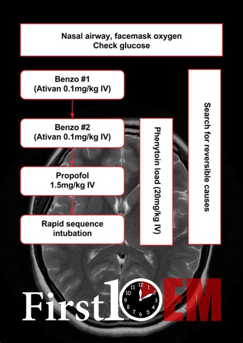 Simplified Status Epilepticus Algorithm First10em 2019 First10EM