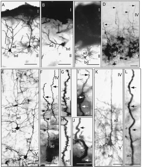 Abnormal Apical Dendrites Of Pyramidal Neurons In The L1 Minus Cerebral Download Scientific